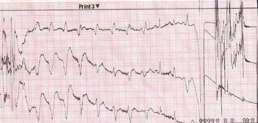 Not The Ordinary - EMS Artifact